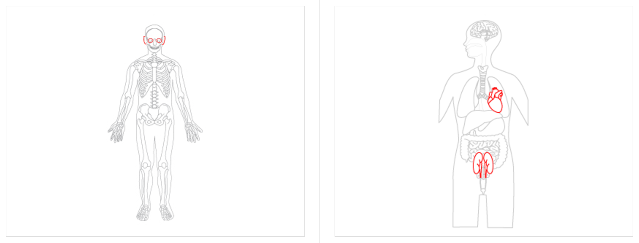 3분안에 배우는 알스트롬 증후군 - goodbye disease